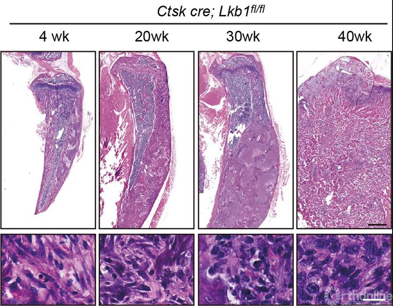 开山之作：邹卫国/康铁邦合作揭示新的骨膜来源中胚层间质前体细胞与骨肿瘤发生机制 | 骨科在线