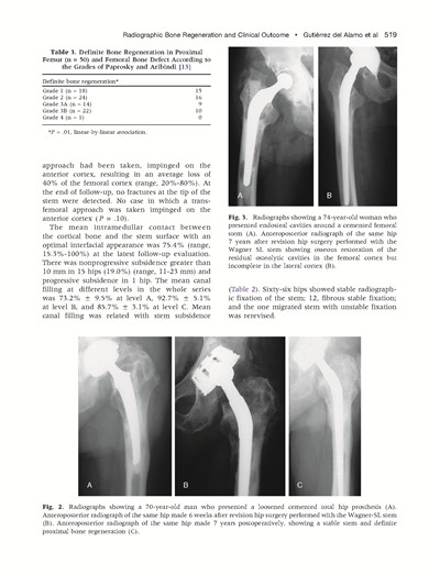 Radiographic Bone Regeneration and Clinical Outcome With the Wagner SL ...