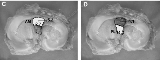 ACL的解剖进展 | 骨科在线