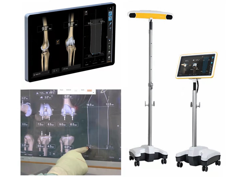 智慧科技引领发展，数字骨科惠及民生——Brainlab KNEE 3正式在上海六院装机 | 骨科在线