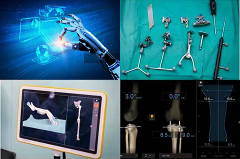 智慧科技引领发展，数字骨科惠及民生——Brainlab KNEE 3正式在上海六院装机 | 骨科在线