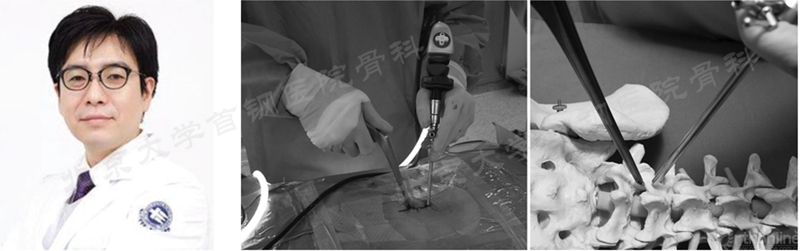 UBE/BESS下腰椎融合术的种类、溯源及对比（上） | 骨科在线