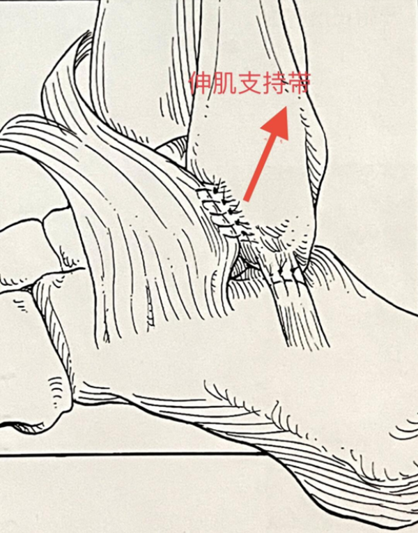 踝关节外侧韧带损伤临床病例报告 | 骨科在线