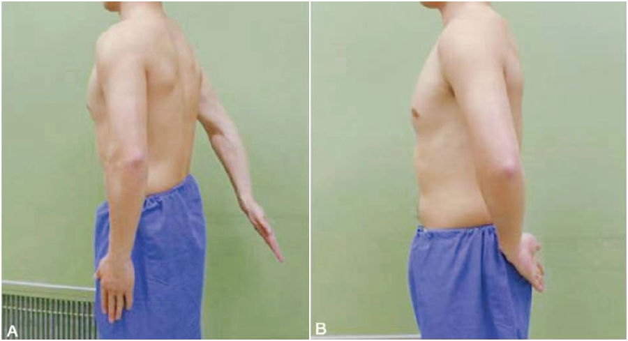 收藏|全面掌握常用肩关节特殊检查法 | 骨科在线